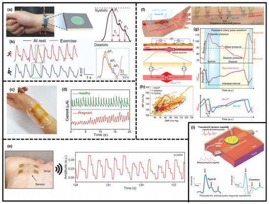 Smart Wearable Systems for Health Monitoring