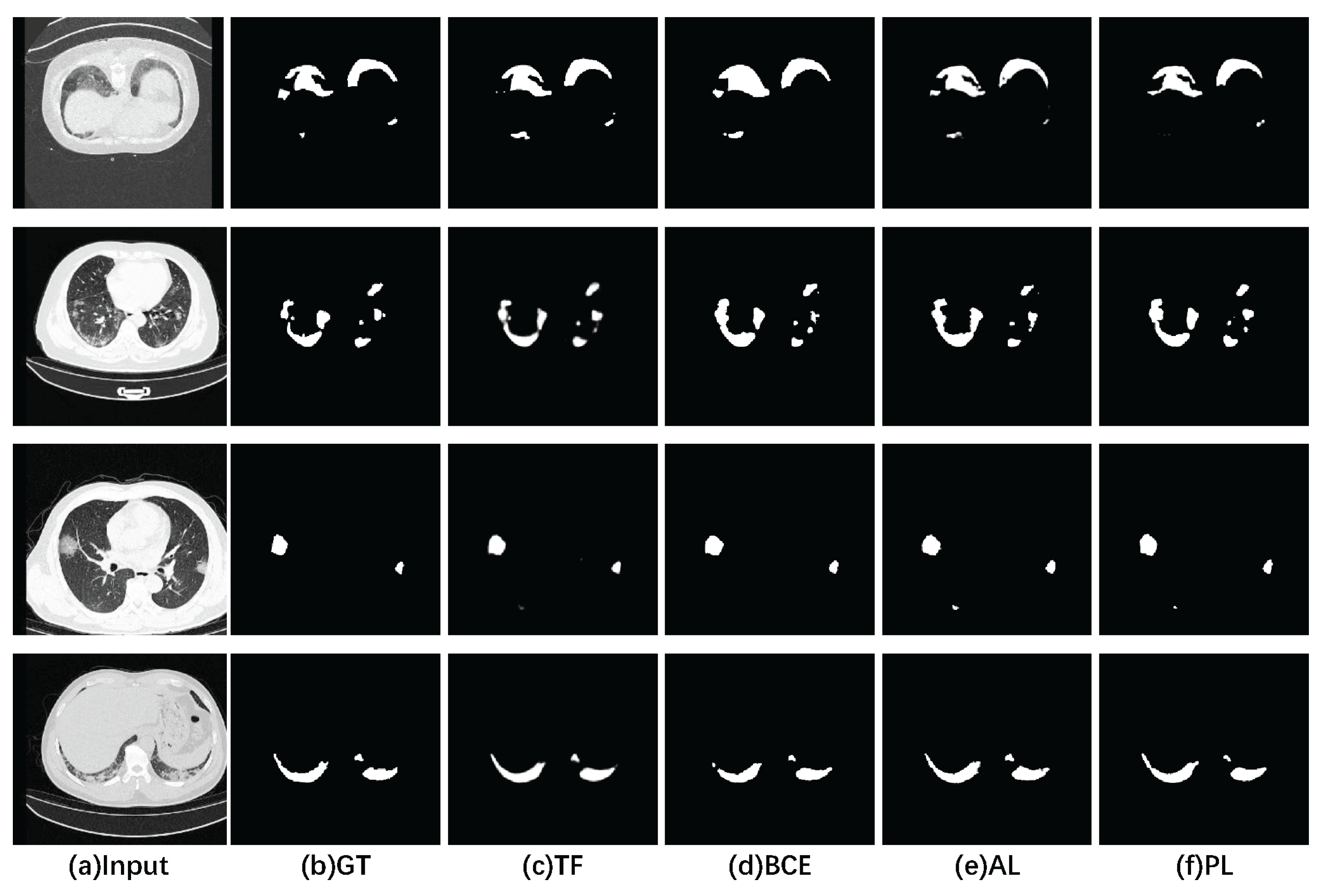 Multi-Attention Segmentation Networks Combined with the Sobel Operator for Medical Images
