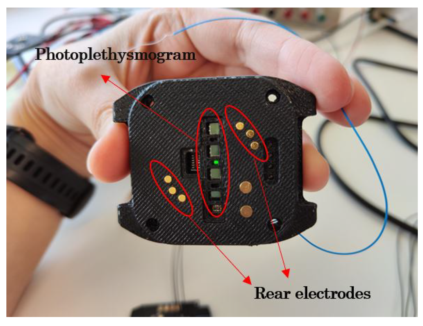 Medical Devices with Embedded Sensor Systems: Design and Development ...