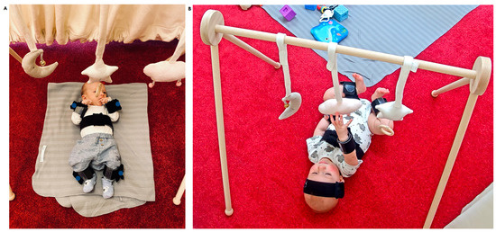 Motor Overflow during Reaching in Infancy: Quantification of Limb ...