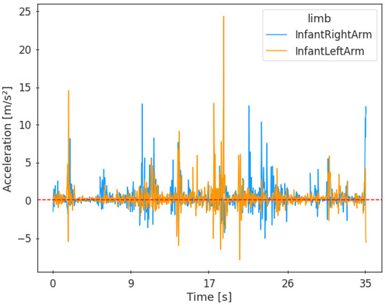 Motor Overflow during Reaching in Infancy: Quantification of Limb ...