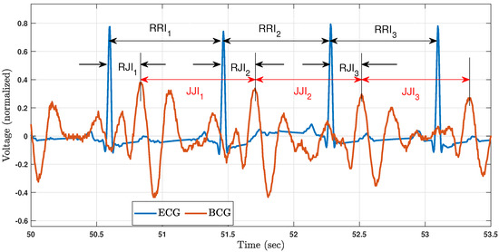 Effects of Ballistocardiogram Peak Detection Jitters on the Quality of Heart Rate Variability ...