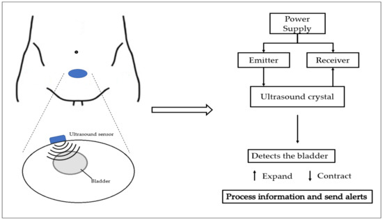 State of the Art of Non-Invasive Technologies for Bladder Monitoring: A ...