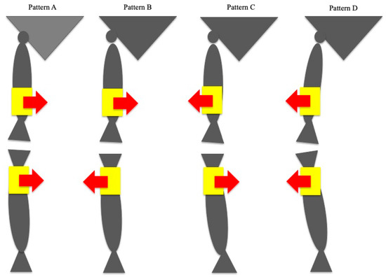Sensors | Free Full-Text | A Novel Classification of Coronal Plane Knee ...