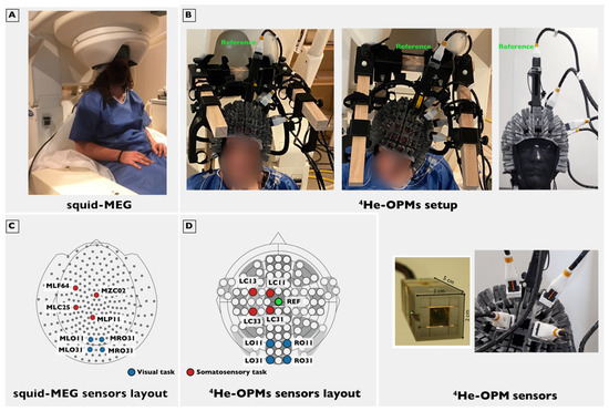 Sensors | Free Full-Text | A New Generation of OPM for High Dynamic and ...
