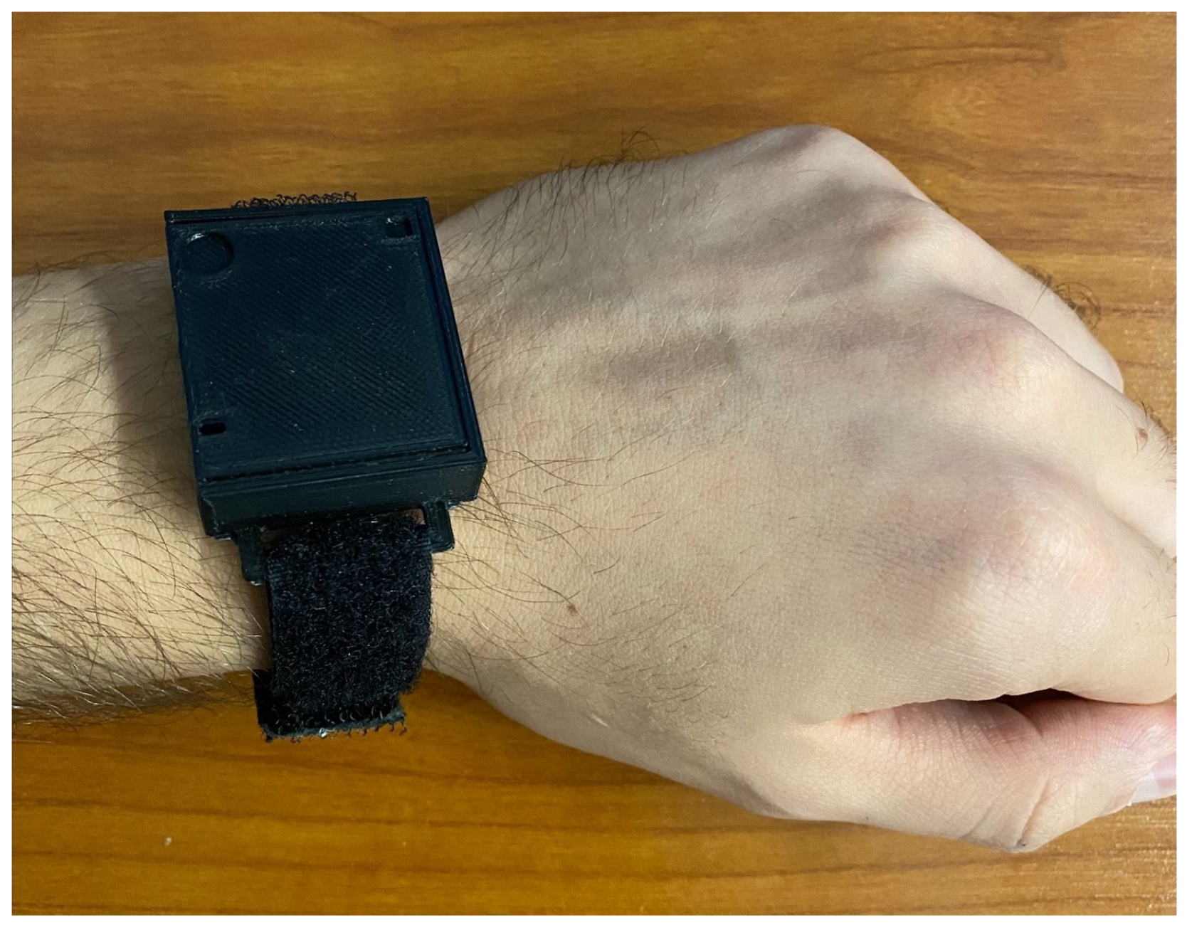 AI-Enabled Smart Wristband Providing Real-Time Vital Signs and Stress ...