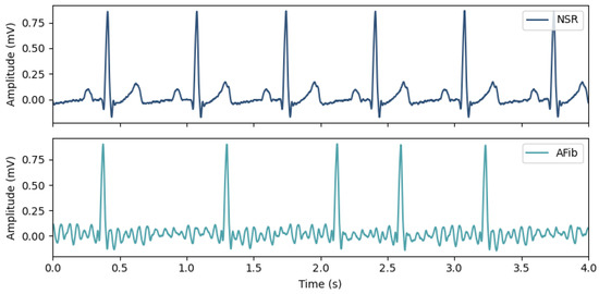Morphological Autoencoders for Beat-by-Beat Atrial Fibrillation ...