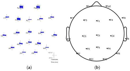 Multiple Dipole Source Position and Orientation Estimation Using Non ...