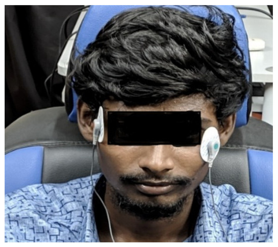 An Electro-Oculogram (EOG) Sensor’s Ability to Detect Driver ...