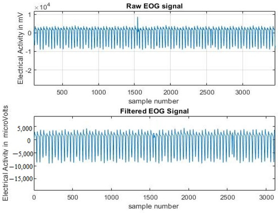 An Electro-Oculogram (EOG) Sensor’s Ability to Detect Driver Hypovigilance Using Machine Learning