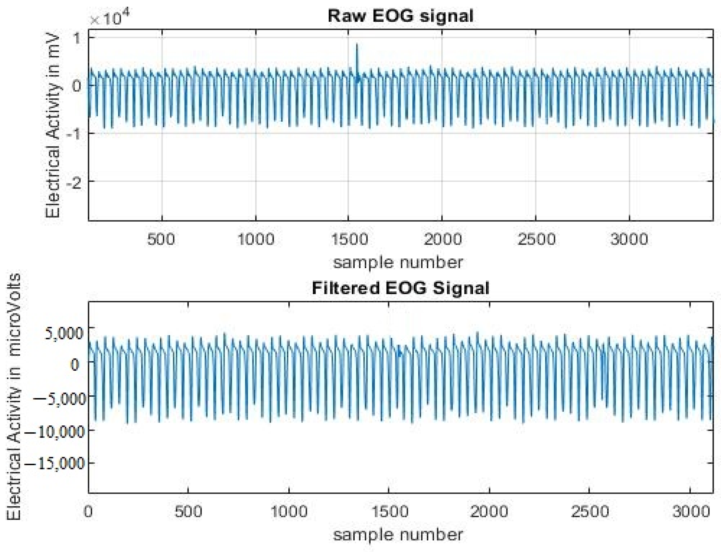 An Electro-Oculogram (EOG) Sensor’s Ability to Detect Driver Hypovigilance Using Machine Learning