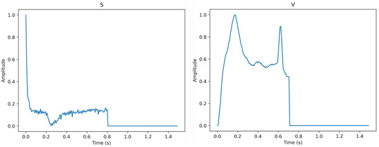 Electrocardiogram Heartbeat Classification for Arrhythmias and ...