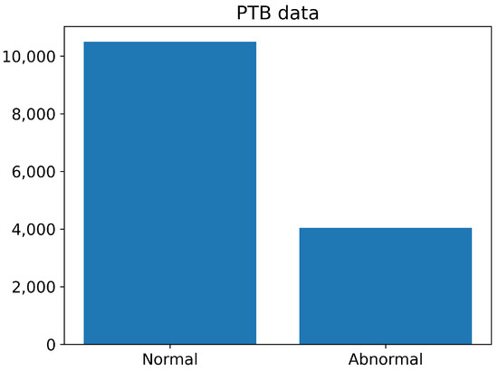 Electrocardiogram Heartbeat Classification for Arrhythmias and ...