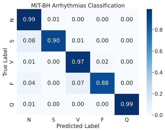 Electrocardiogram Heartbeat Classification for Arrhythmias and Myocardial Infarction