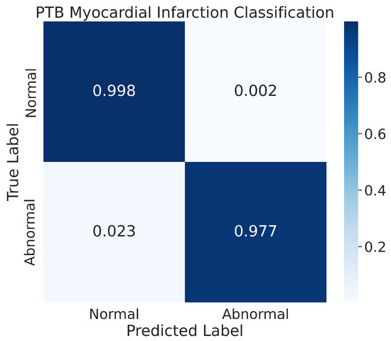 Electrocardiogram Heartbeat Classification for Arrhythmias and Myocardial Infarction