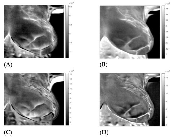 Dynamic Vascular Imaging Using Active Breast Thermography
