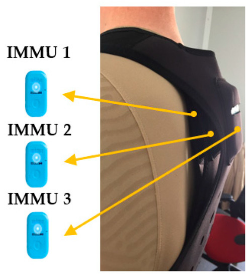 Assessment of a New Change of Direction Detection Algorithm Based on ...