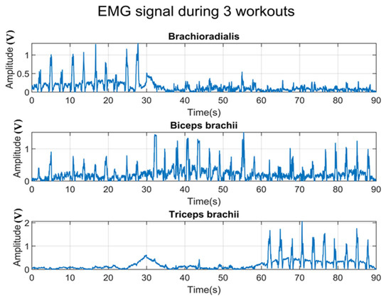 Human Arm Workout Classification by Arm Sleeve Device Based on Machine ...