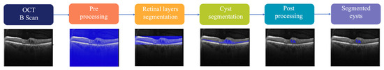 A Review of Machine Learning Algorithms for Retinal Cyst Segmentation ...