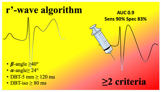 Sensors | Free Full-Text | The r’-Wave Algorithm: A New Diagnostic Tool ...