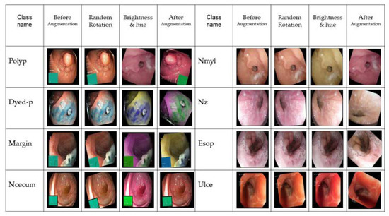 Endoscopic Image Classification Based on Explainable Deep Learning