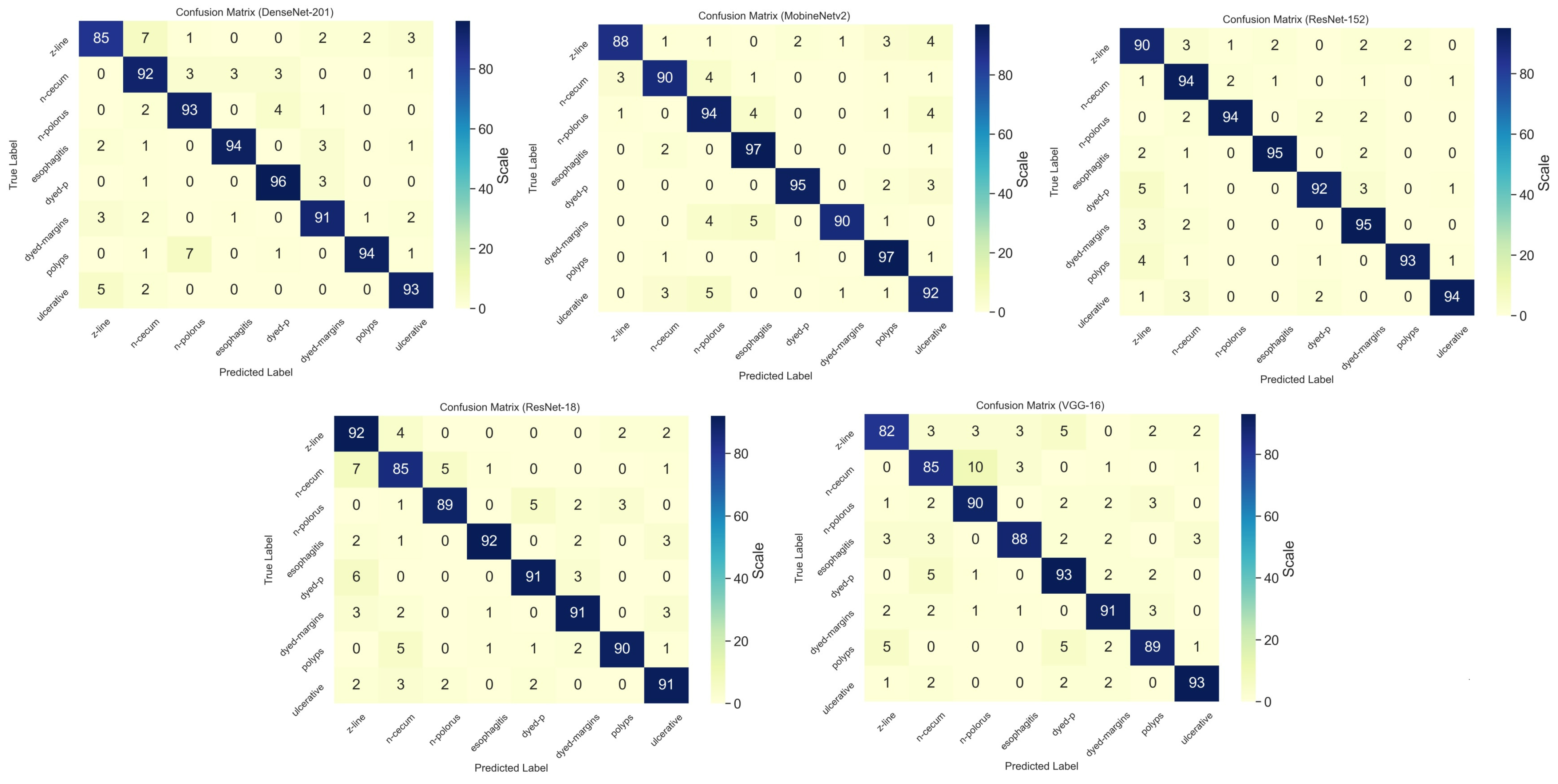 Endoscopic Image Classification Based on Explainable Deep Learning