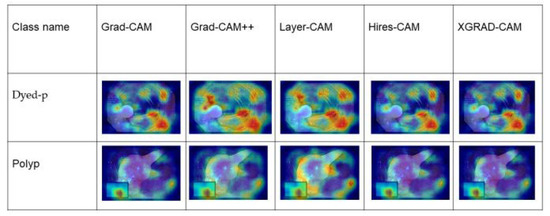 Endoscopic Image Classification Based on Explainable Deep Learning