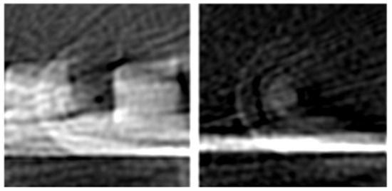 Three-Dimensional Immersion Scanning Technique: A Scalable Low-Cost ...