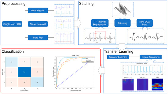 Sensors | Free Full-Text | An ECG Stitching Scheme for Driver ...