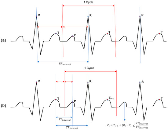 Sensors | Free Full-Text | An ECG Stitching Scheme for Driver ...