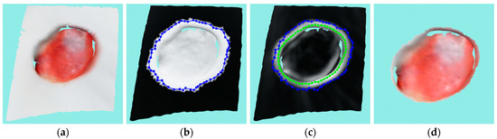 Sensors | Free Full-Text | 2D/3D Wound Segmentation and Measurement ...