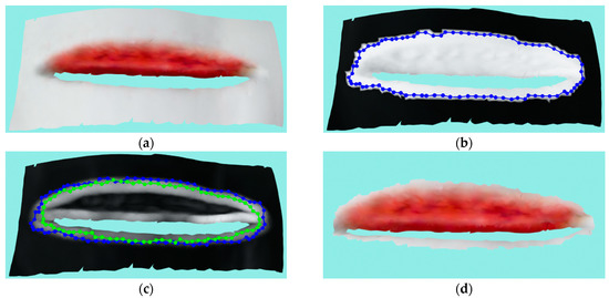 Sensors | Free Full-Text | 2D/3D Wound Segmentation and Measurement ...