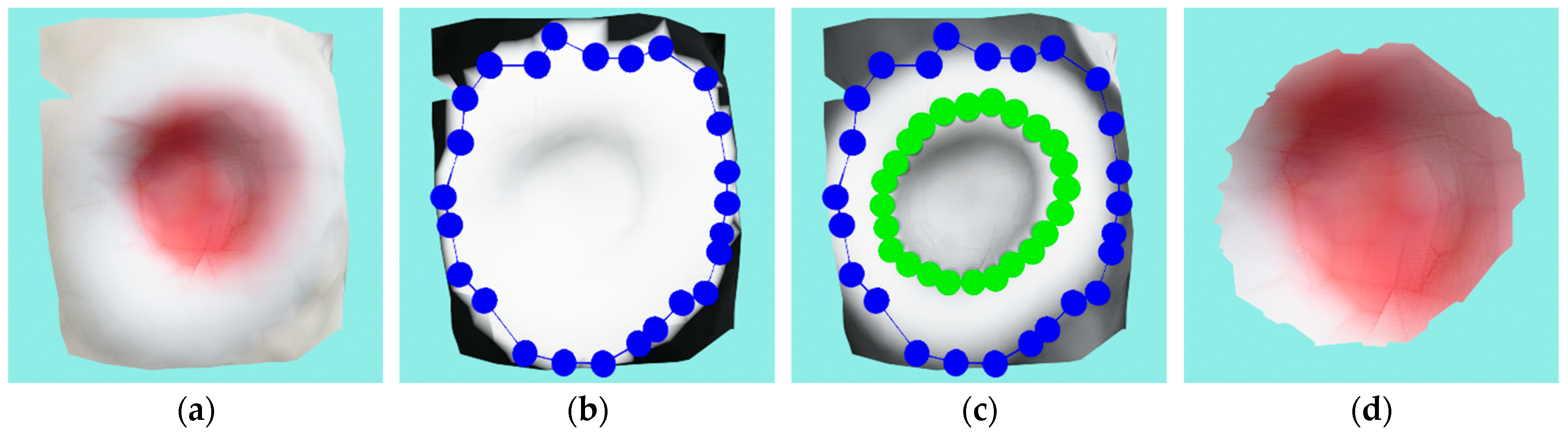 Sensors | Free Full-Text | 2D/3D Wound Segmentation and Measurement ...