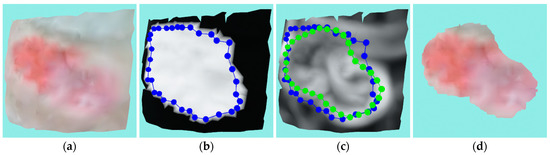 Sensors | Free Full-Text | 2D/3D Wound Segmentation and Measurement ...
