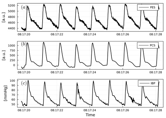 Intraoperative Beat-to-Beat Pulse Transit Time (PTT) Monitoring via Non ...