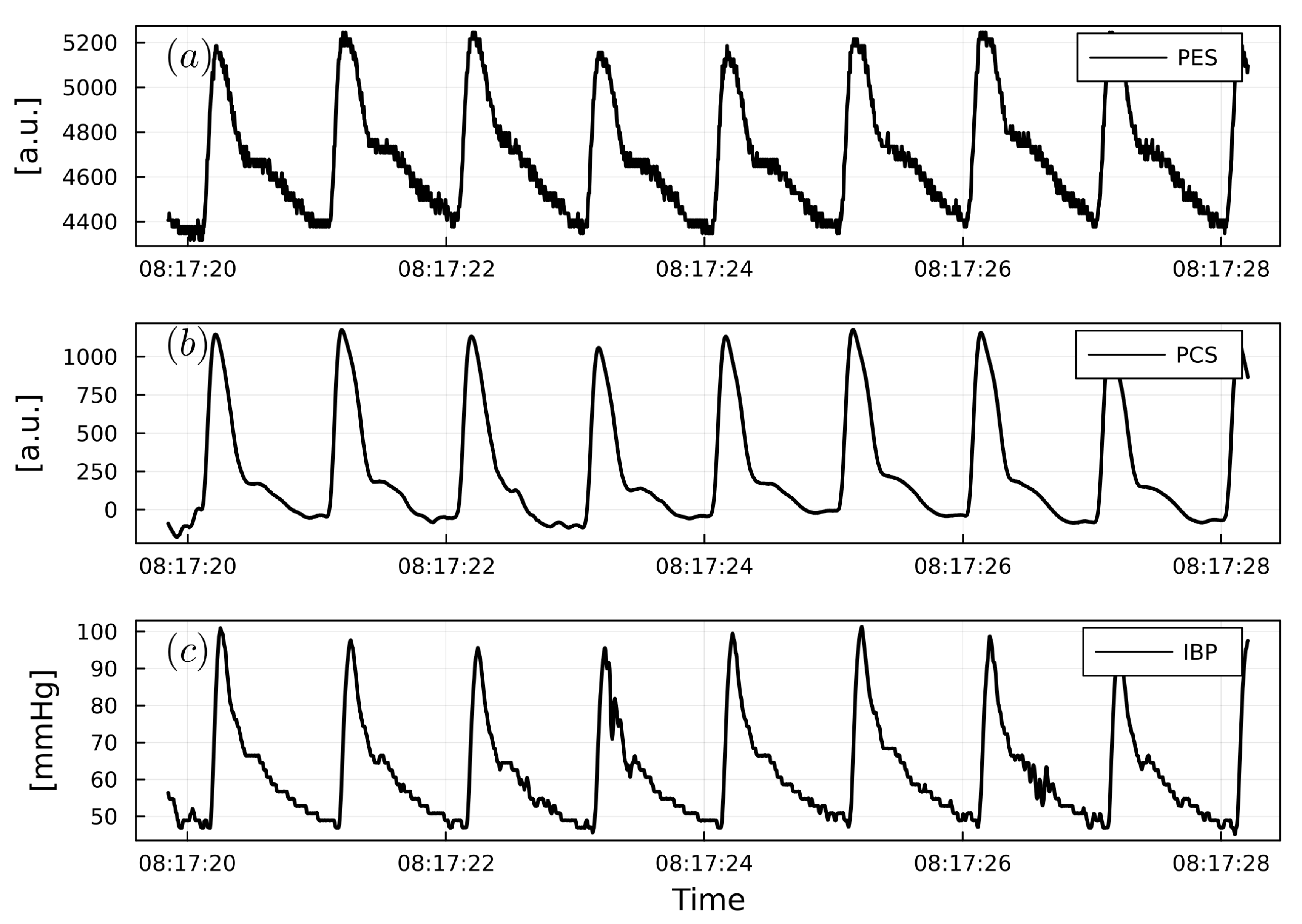 Intraoperative Beat-to-Beat Pulse Transit Time (PTT) Monitoring via Non ...