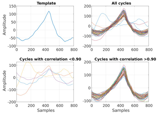 An In-Ear PPG-Based Blood Glucose Monitor: A Proof-of-Concept Study