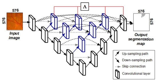 Automatic Detection of Microaneurysms in Fundus Images Using an Ensemble-Based Segmentation Method