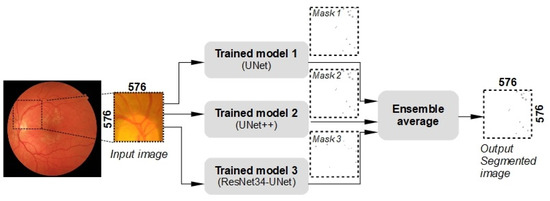 Automatic Detection of Microaneurysms in Fundus Images Using an Ensemble-Based Segmentation Method