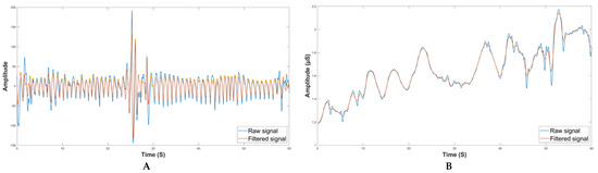 A Method for Stress Detection Using Empatica E4 Bracelet and Machine ...