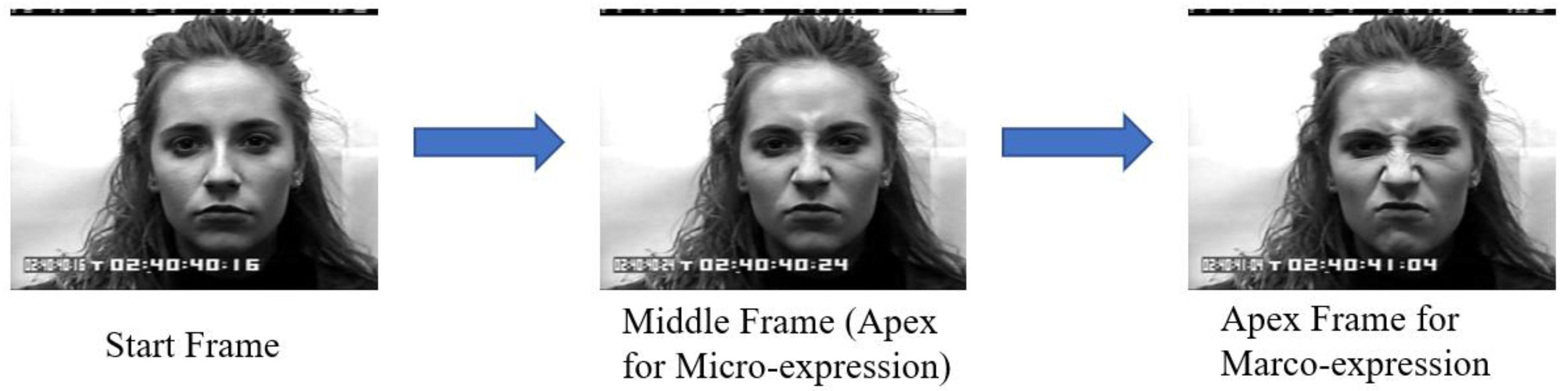 Facial Micro-Expression Recognition Using Double-Stream 3D Convolutional Neural Network with ...