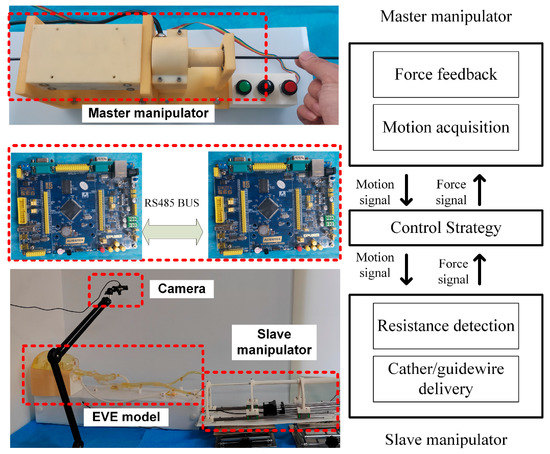 A Novel Master–Slave Interventional Surgery Robot with Force Feedback ...