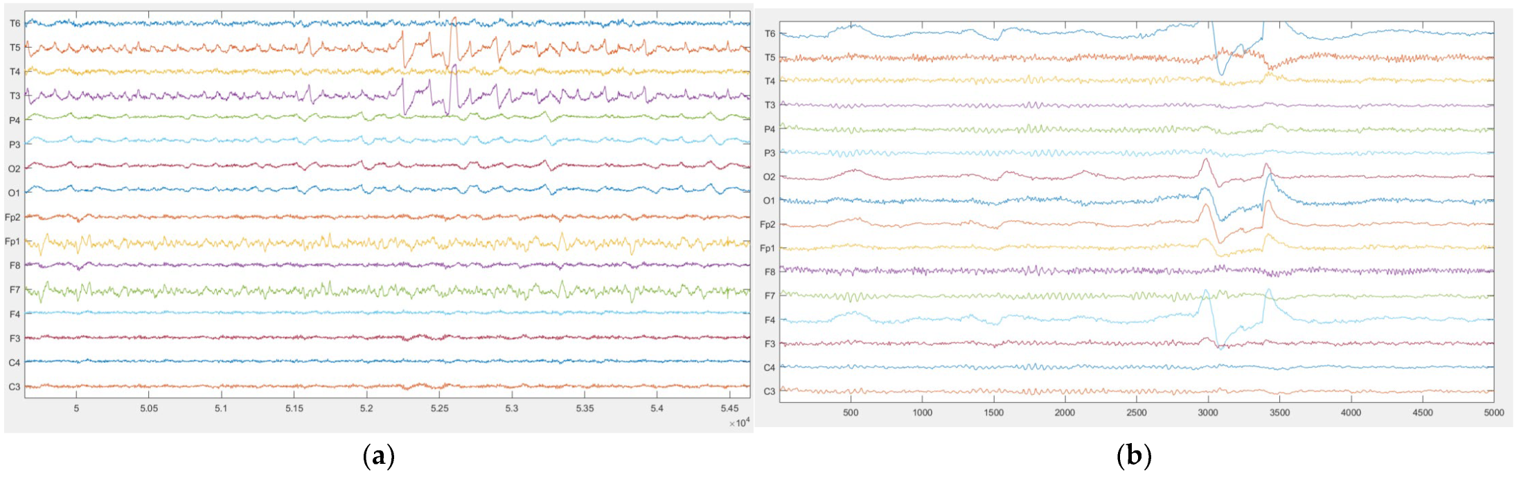 Assessment of a 16-Channel Ambulatory Dry Electrode EEG for Remote Monitoring