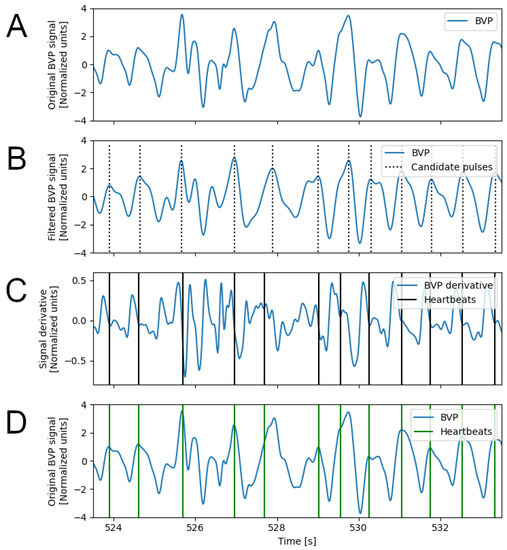 Performance Assessment of Heartbeat Detection Algorithms on ...