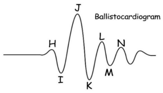 Sensors | Free Full-Text | Mattress-Based Non-Influencing Sleep Apnea Monitoring System
