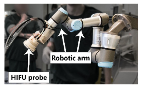 Review of Robot-Assisted HIFU Therapy