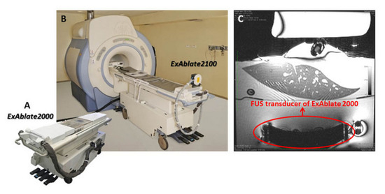 Review of Robot-Assisted HIFU Therapy