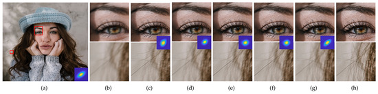 Kernel Estimation Using Total Variation Guided GAN for Image Super-Resolution