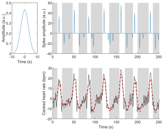 Sparse Decomposition of Heart Rate Using a Bernoulli-Gaussian Model: Application to Sleep Apnoea ...