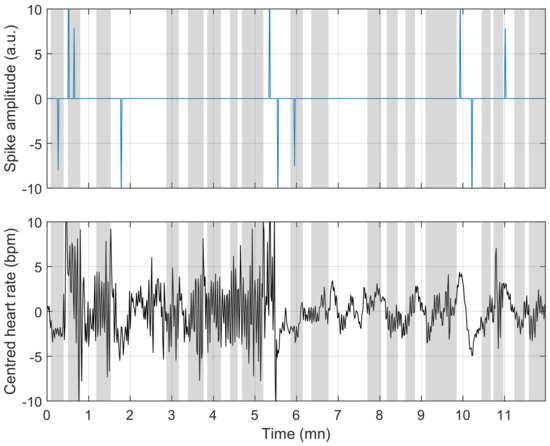 Sparse Decomposition of Heart Rate Using a Bernoulli-Gaussian Model: Application to Sleep Apnoea ...